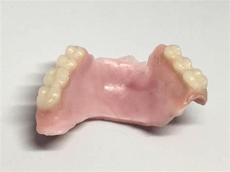 Image result for DIY Tooth Bridge Kit