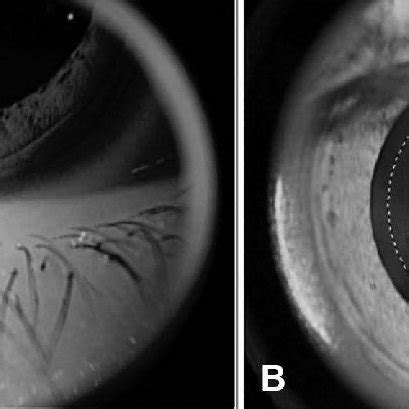 Image result for Oct Line Scan