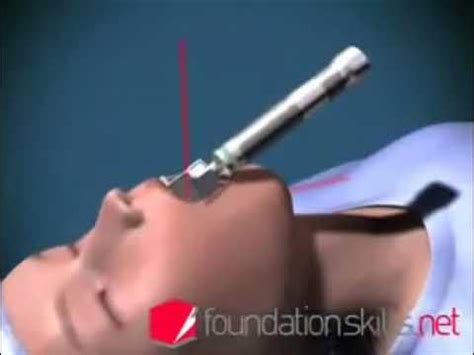 Image result for Intubate Procedure