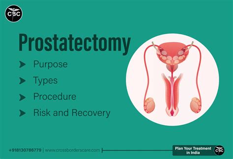Image result for Prostatectomy Surgery Procedure
