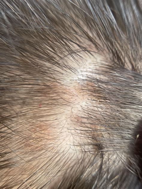 Image result for Seb Derm