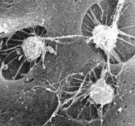 Image result for Bone Cells Function
