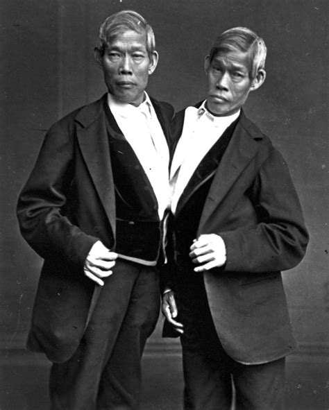 Image result for Java Island Siamese Twins