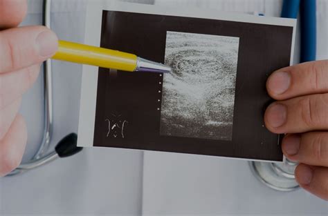 Image result for Pronounce Intussusception