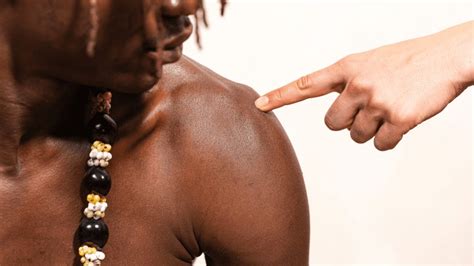 Image result for AC Joint Dysfunction