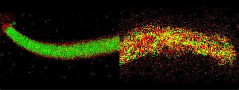 Image result for Simplex System Anodes