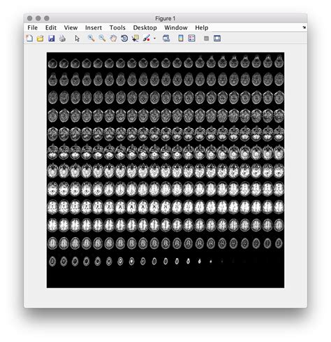 Image result for Python MATLAB Brain Surface