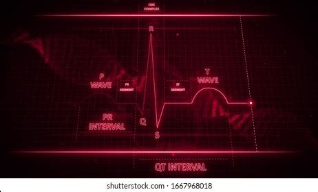 Image result for PR Interval ECG Boxes