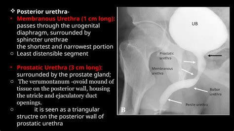 Image result for Urethrogram Technique
