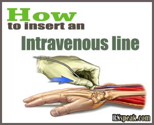 Image result for Insert IV Line