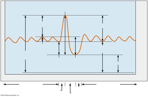 Image result for How to Read Spirogramm