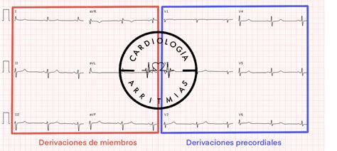 Image result for ECG 12 Derivaciones Normal