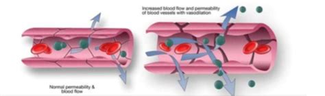 Image result for Distributive Shock