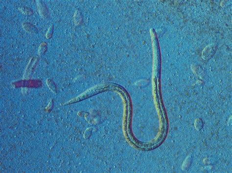 Image result for Pinworm Skin