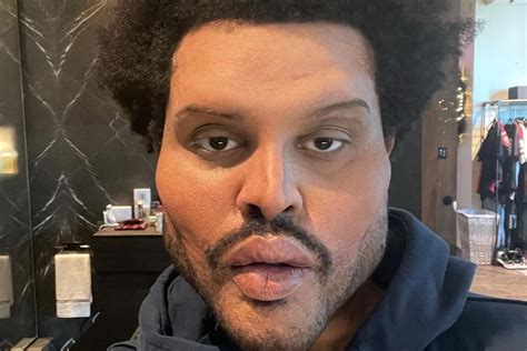 Image result for The Weeknd Botox