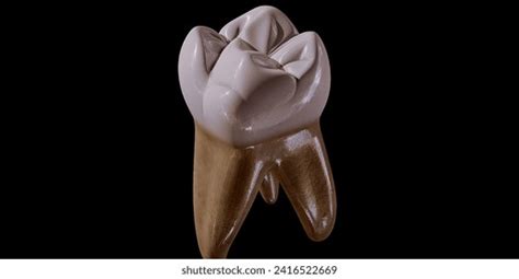 Image result for Maxillary First Molar