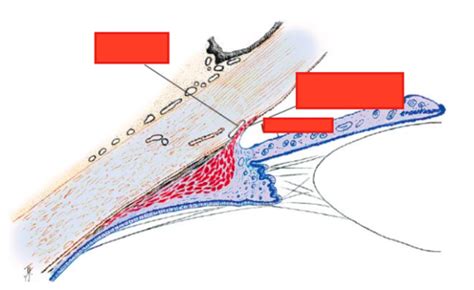 Image result for Aqueous Humor Outflow