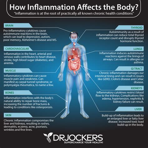 Image result for How to Reduce Inflammation Quickly