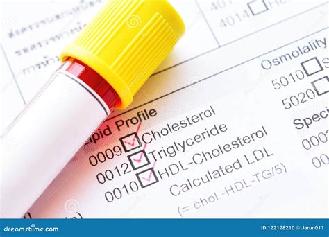 Image result for Lipid Profile Testing