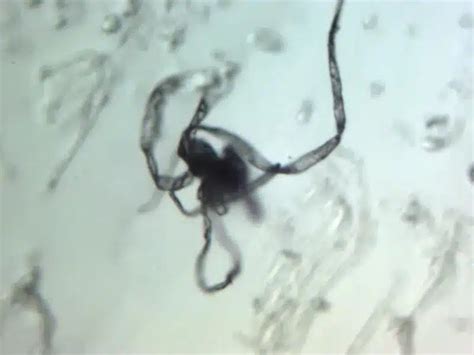 Image result for Pinworm Tape Test Procedure