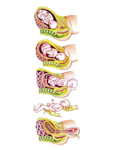 Image result for Childbirth Explained