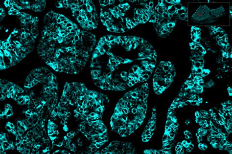 Image result for Multiplex IHC Neun