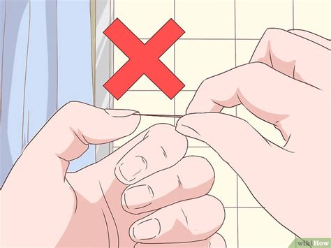 Image result for Remove a Splinter