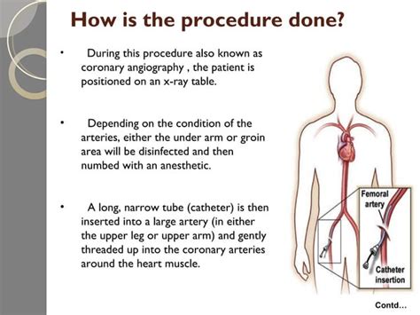 Image result for Different Types of Angiogram