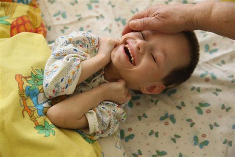 Image result for Birth Defects From Chernobyl Disaster