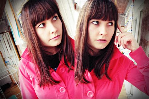 Image result for Java Island Siamese Twins