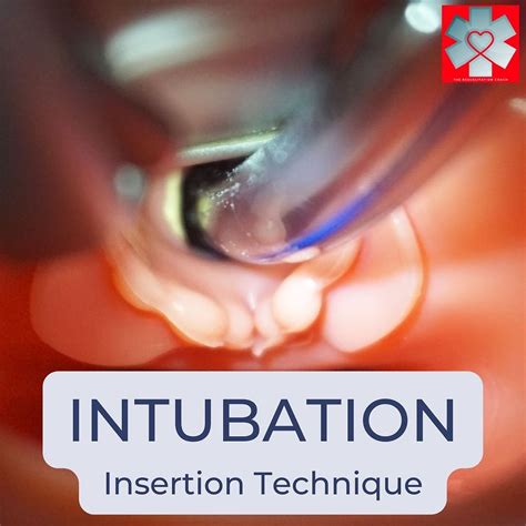 Image result for Intubation Steps