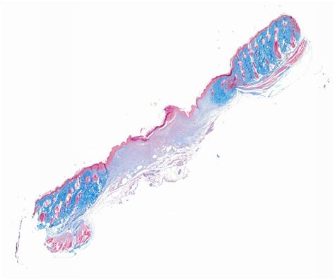 Image result for Slide Scan Tutorial