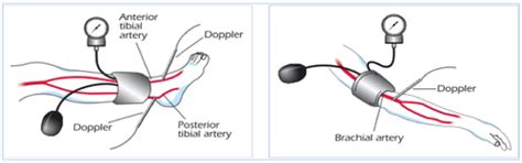 Image result for Circulation Test Procedure