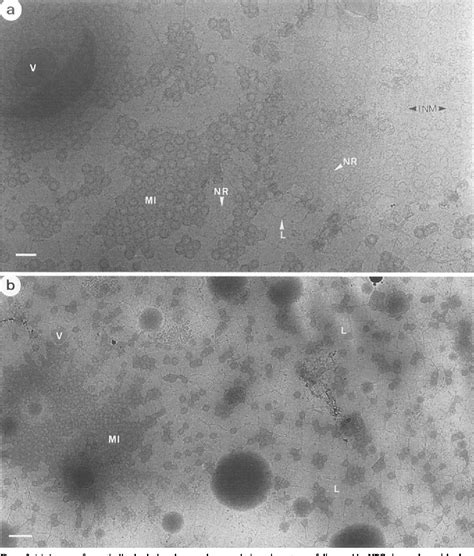 Image result for Computer Nuclear Pore Comple