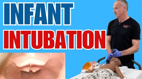 Image result for How to Do Intubation