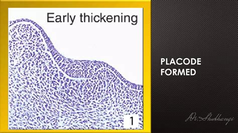 Image result for Tooth Development Video