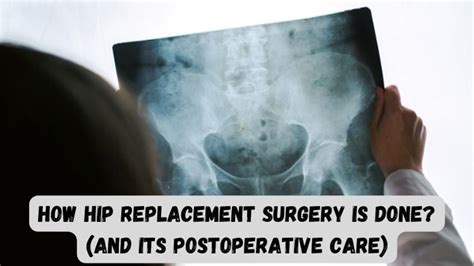 Image result for Hip-Replacement Post Operative Care