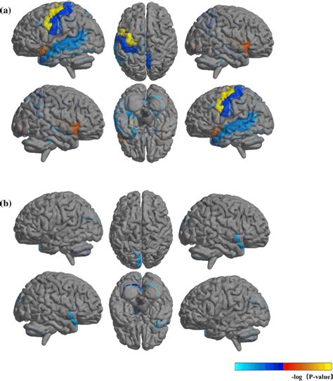 Here shows the brain regions in the brain topological map, which are ...