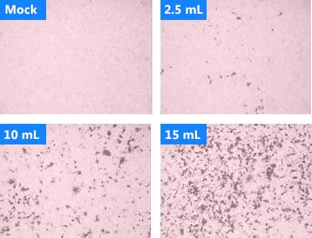 Image result for AAV Vector Purification Kit