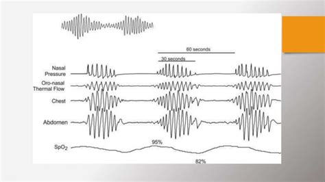 Image result for Abnormal Breating Patterns
