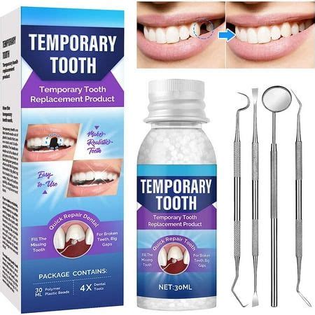 Image result for DIY Front Tooth Chip Repair Kit