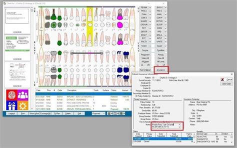 Image result for Eaglesoft Patient Notes