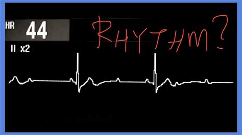 Image result for ACLS Rhythm Test