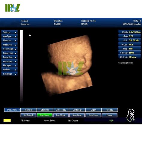 Image result for Color 4D Ultrasound Machine
