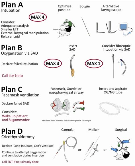 Image result for Different Types of Intubation