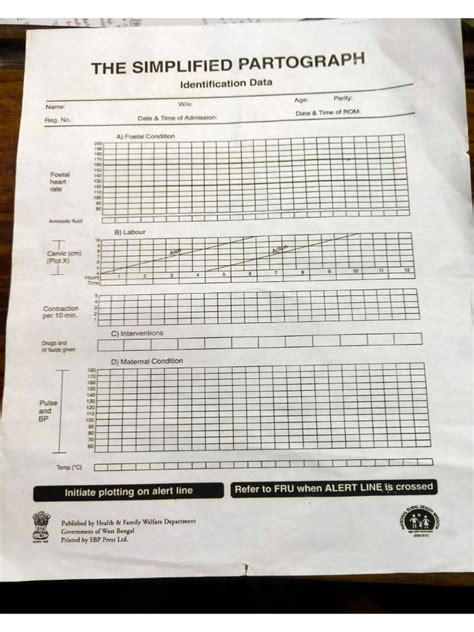 Image result for Partogram Design