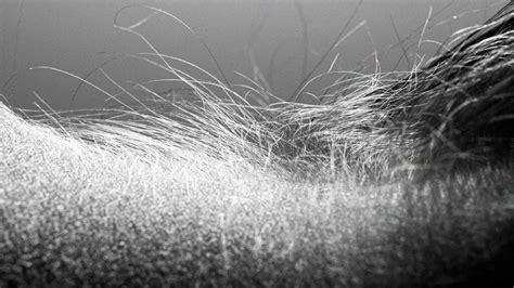 Image result for Neck Arthritis Computer