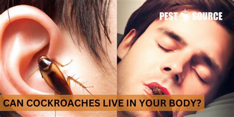 Image result for Cockroach Bites On Humans