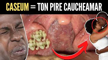 Image result for Comment Reprogrammer L Amidal