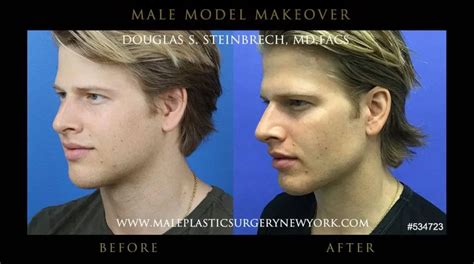 Image result for Male Reprogram